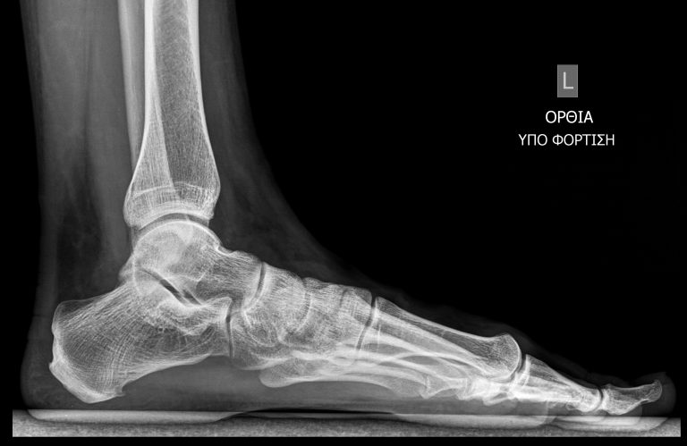 Ακτινολογικό Τμήμα - Ψηφιακή Ακτινογραφία - Ιατρική Απεικόνιση